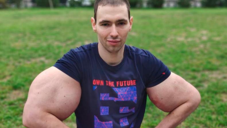 El Popeye ruso sufrió la explosión de un brazo en medio del combate de MMA